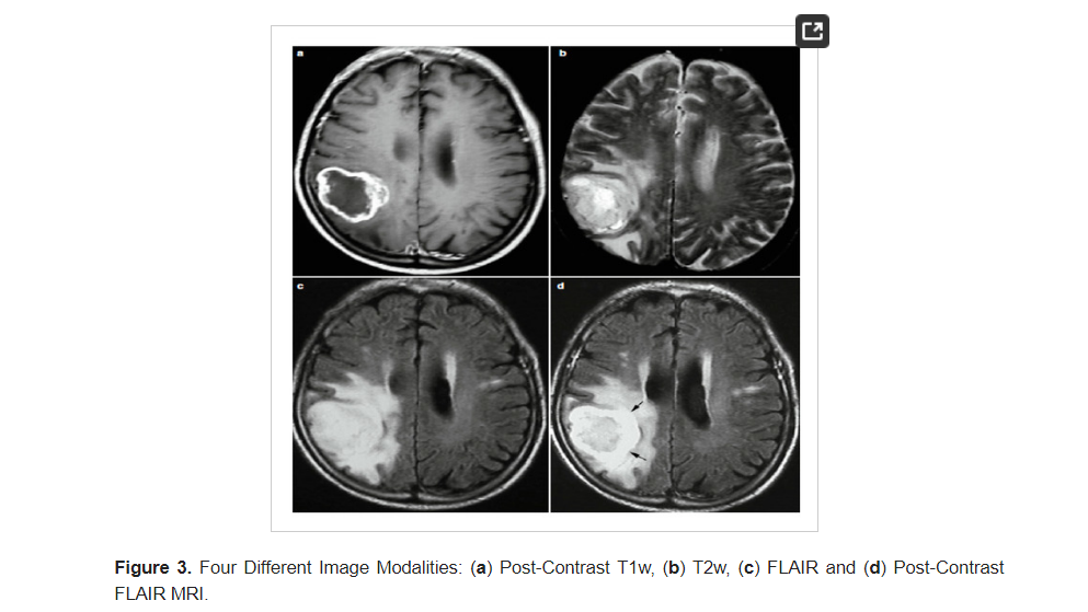Deep Learning-Based Studies in Pediatric Brain Tumors Imaging ...
